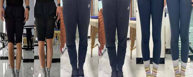 你的O型腿如何通过运动纠正好？ | 咕咚文章